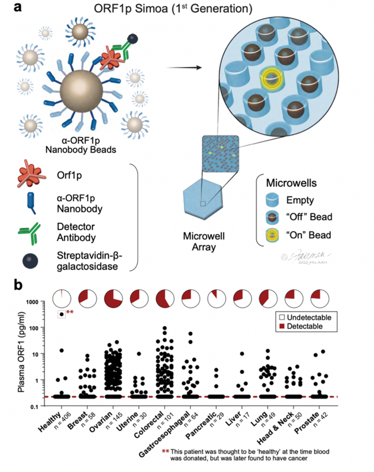 Research Spotlight – Ultrasensitive detection of circulating LINE-1 ...